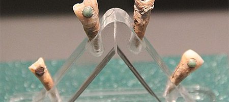 Glue Used by Ancient Maya Dentists to Affix Gems to Teeth Delivers ...